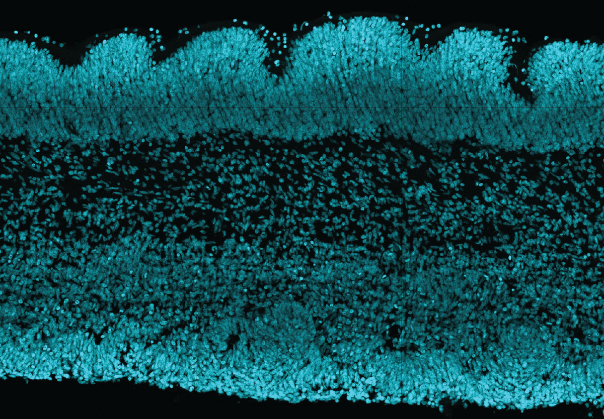 How does the human brain fold?: MPI-CBG