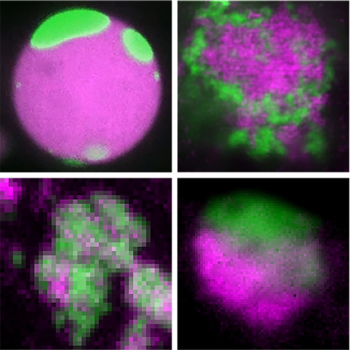 Condensates Inside Condensates—Triggering Disease?: MPI-CBG